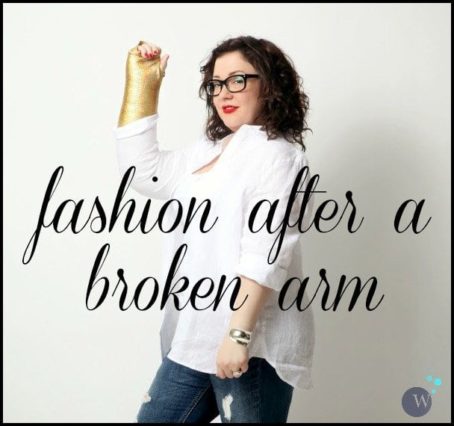 Ask Allie: Fashion After a Broken Arm | Wardrobe Oxygen